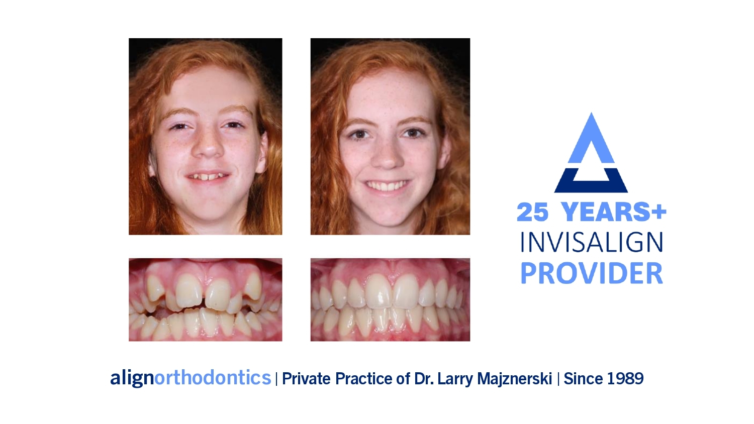 Invisalign Treatment by Dr. Majzerski-Mize - 15th Annual Jay & Betty ...