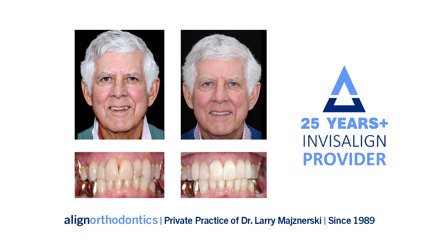 Invisalign Treatment by Dr. Majzerski-Mize - 15th Annual Jay & Betty ...